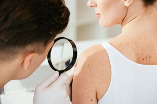 Choroby skóry – jak je rozpoznać i leczyć? - UrodaiZdrowie.pl portal o ...